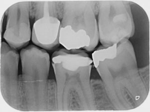 Sri Sinar Dental Clinic | Dental xrays